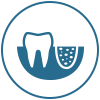 blue-icon-bone-graft – Core Dental Specialty Group